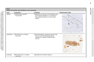 Urinalysis Interpretation and Clinical Correlations.pdf