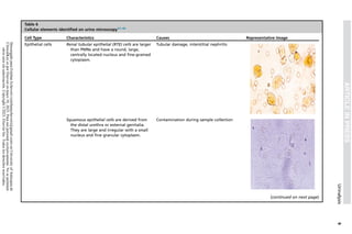 Urinalysis Interpretation and Clinical Correlations.pdf