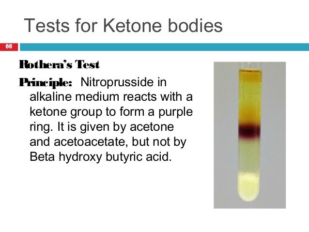 Medical Breakthrough Chemical Composition Of Human Urine