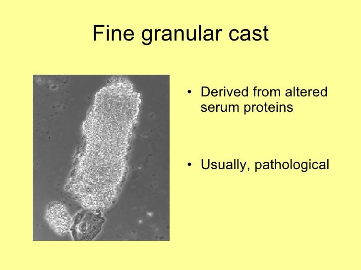 CME - Urinalysis