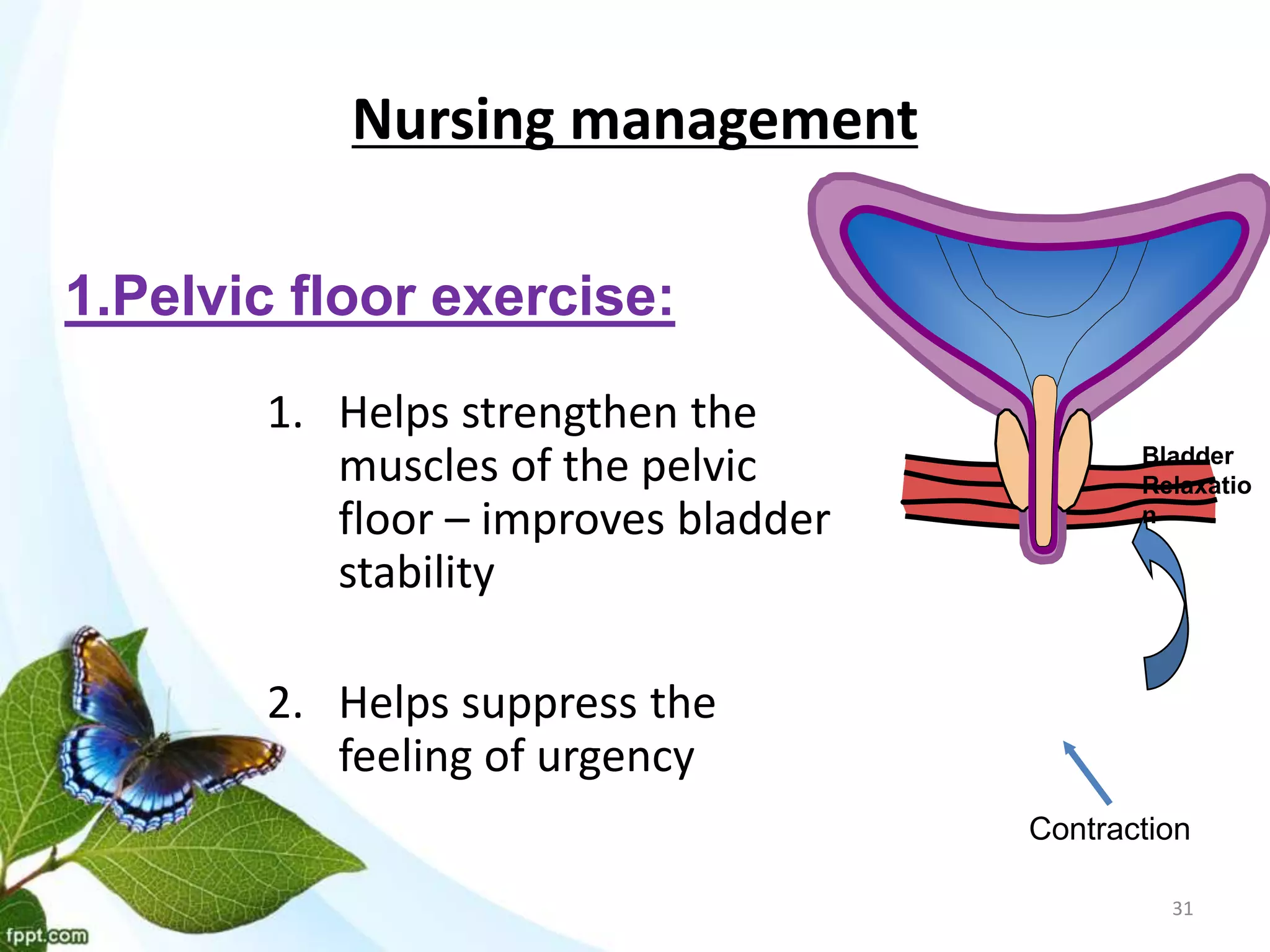 Urinary incontinence | PPTX