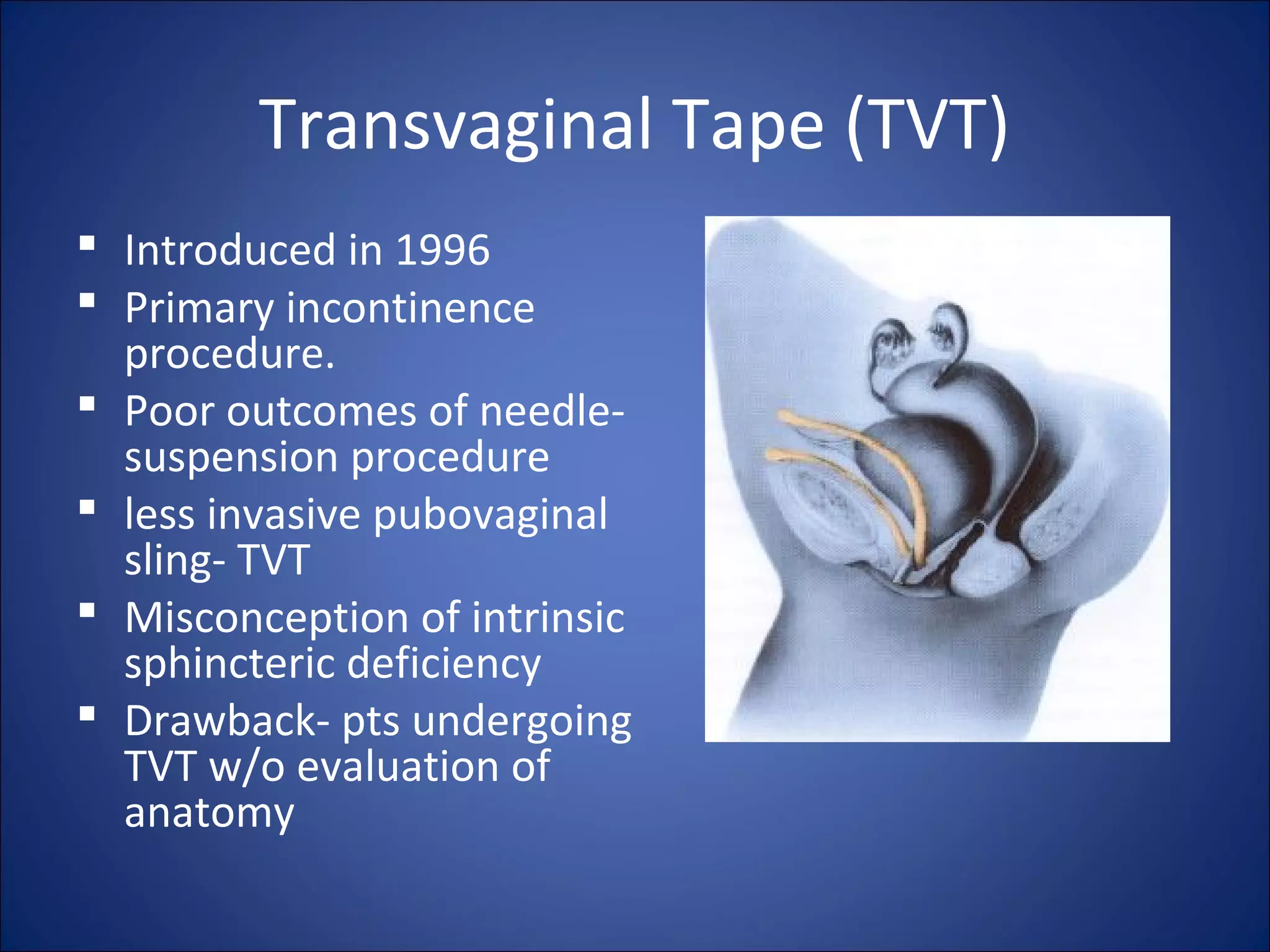 Urinary Incontinence Surgery | PPT