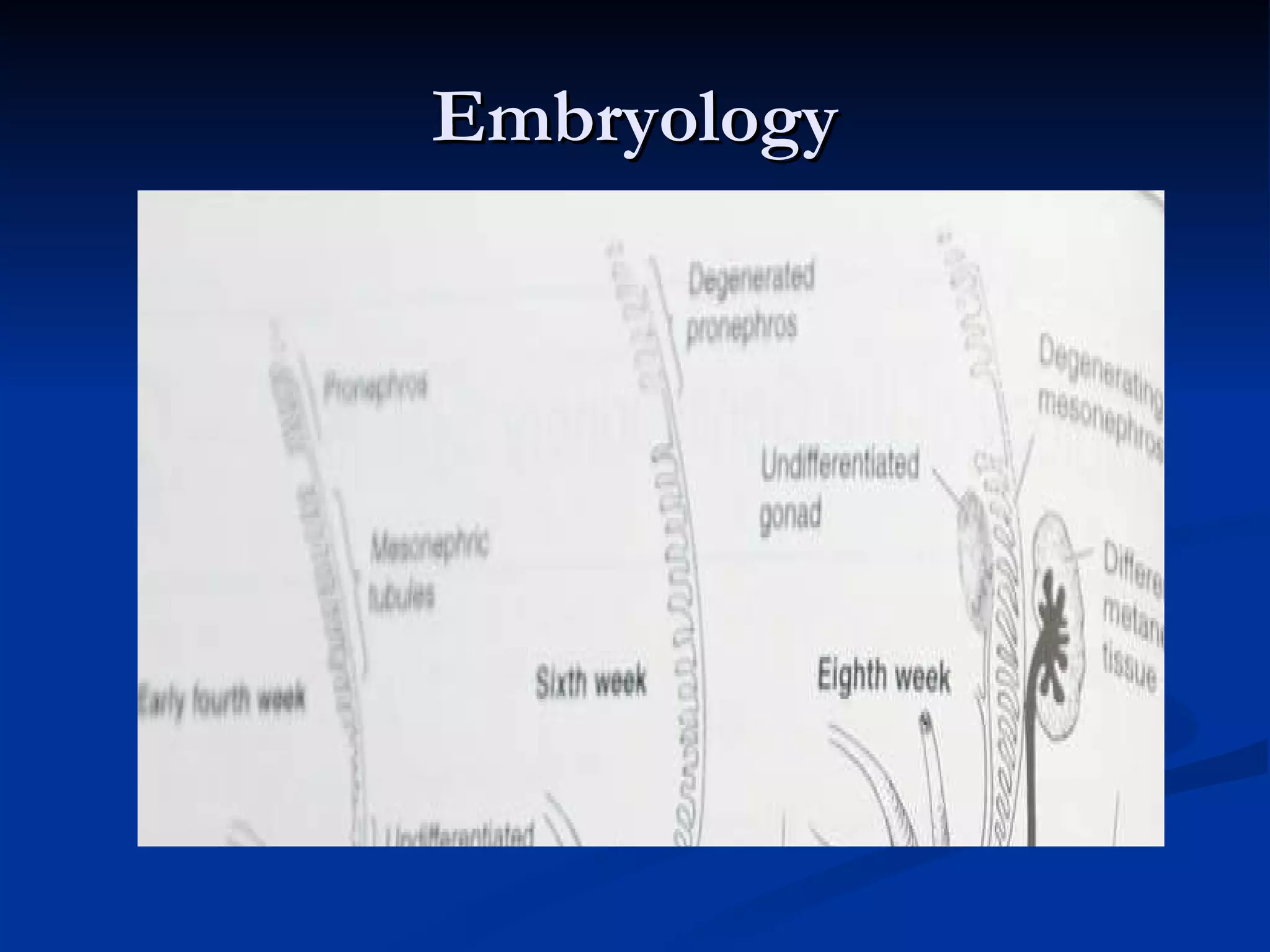 Urinary Outflow Obstruction | PPT