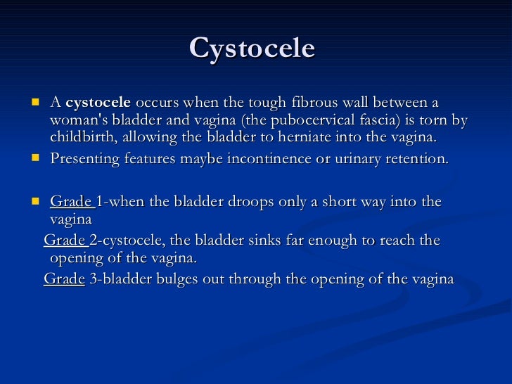 Cystocele Grading