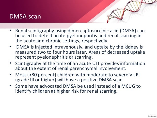 Urinary tract-infections-children
