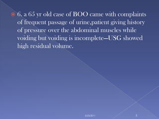 Urinary bladder | PPTX