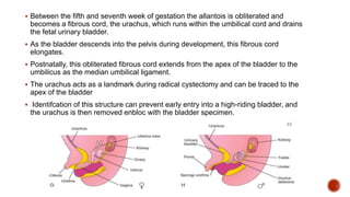 Surgical Anatomy of Urinary bladder.pptx