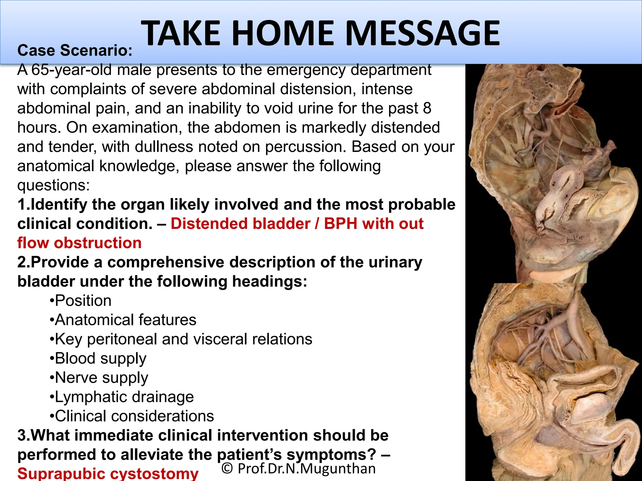 URINARY BLADDER-Prof.Dr.N.Mugunthan KMMC.pdf