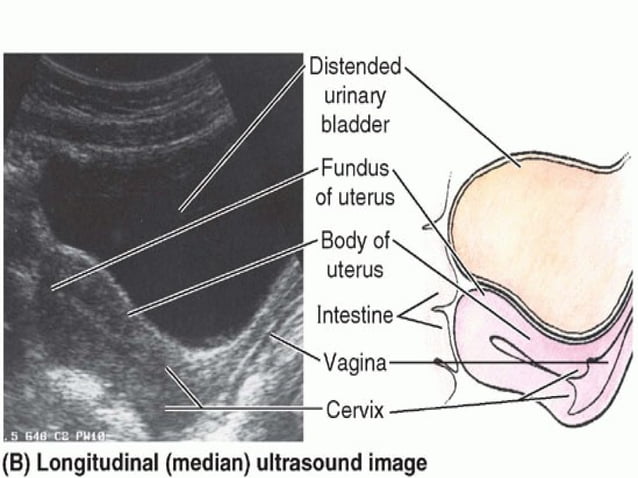 Structure and development of Urinary bladder by Dr. Tatheer