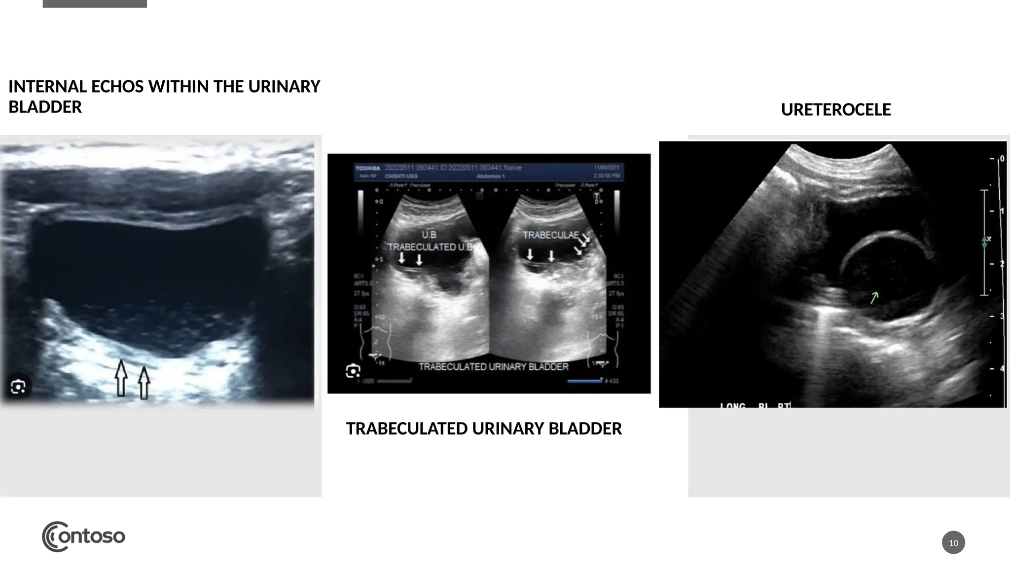 Urinary bladder and Prostate anatomy ppt.pptx