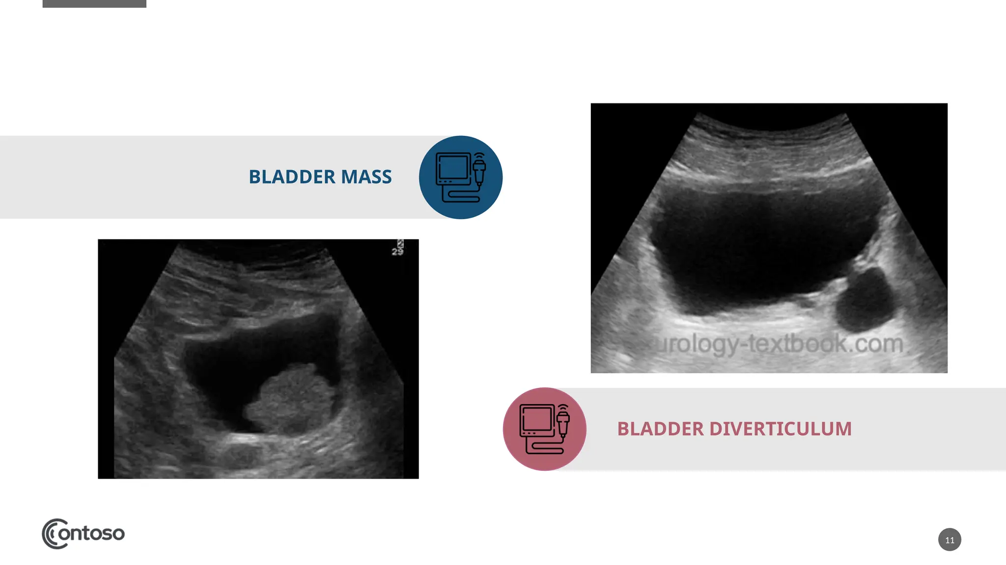 Urinary bladder and Prostate anatomy ppt.pptx
