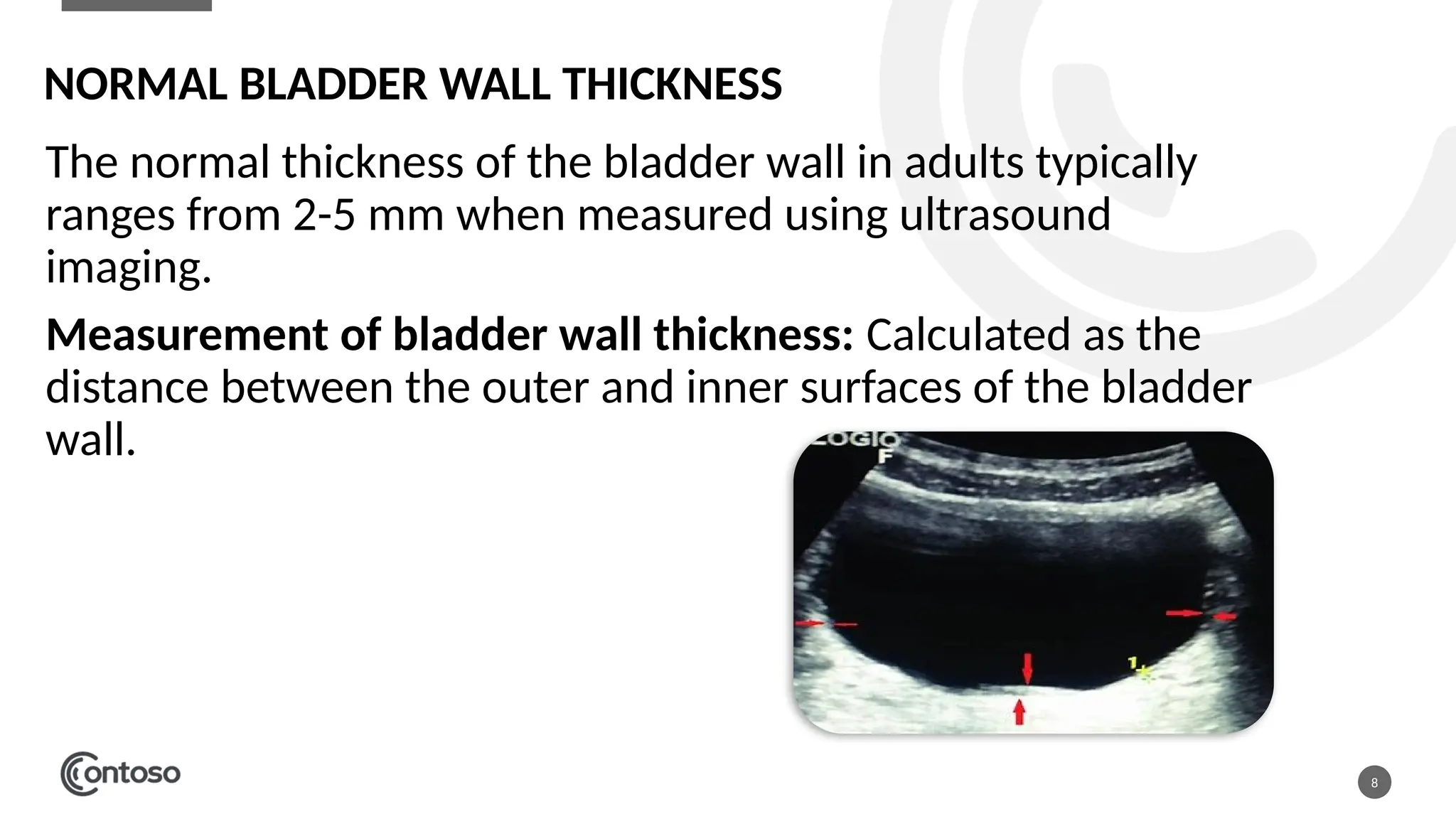 Urinary bladder and Prostate anatomy ppt.pptx