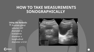 Urinary bladder and Prostate anatomy ppt.pptx