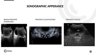 Urinary bladder and Prostate anatomy ppt.pptx