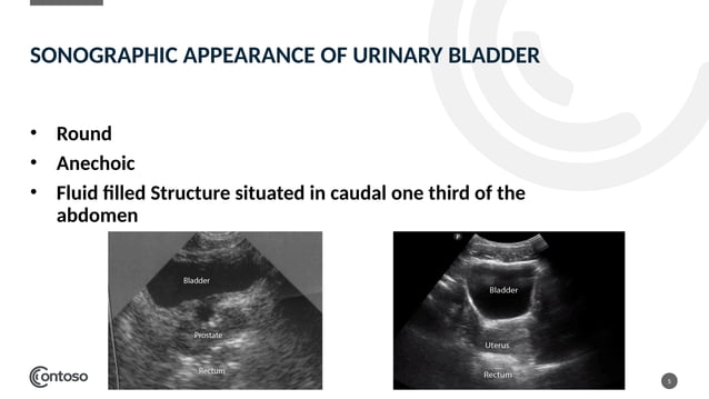 Urinary bladder and Prostate anatomy ppt.pptx