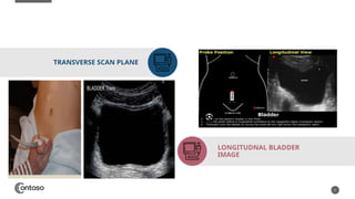 Urinary bladder and Prostate anatomy ppt.pptx