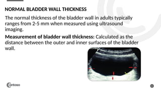 Urinary bladder and Prostate anatomy ppt.pptx