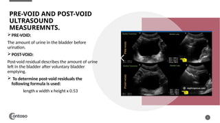 Urinary bladder and Prostate anatomy ppt.pptx