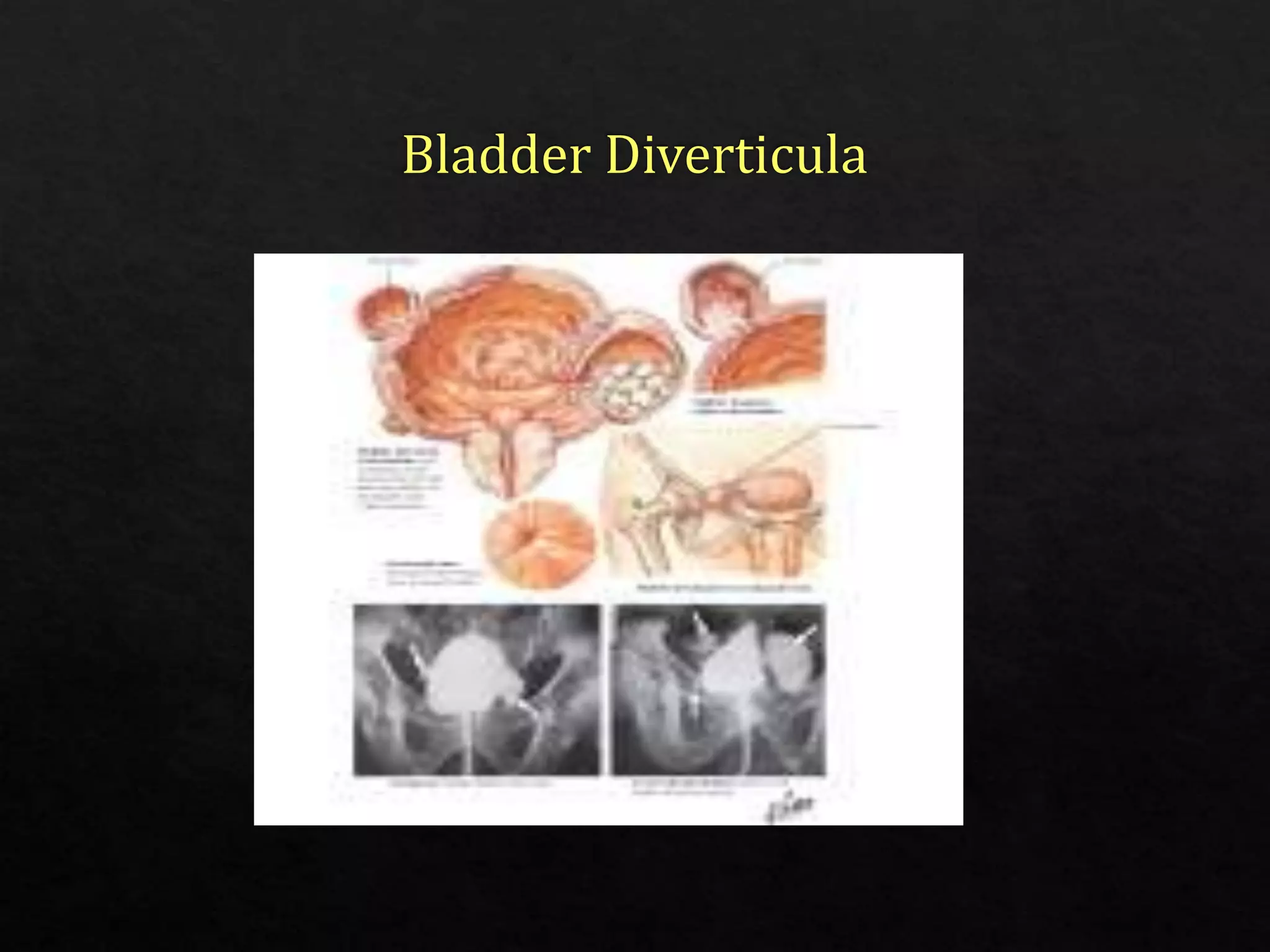urinary bladder conditions.ppt