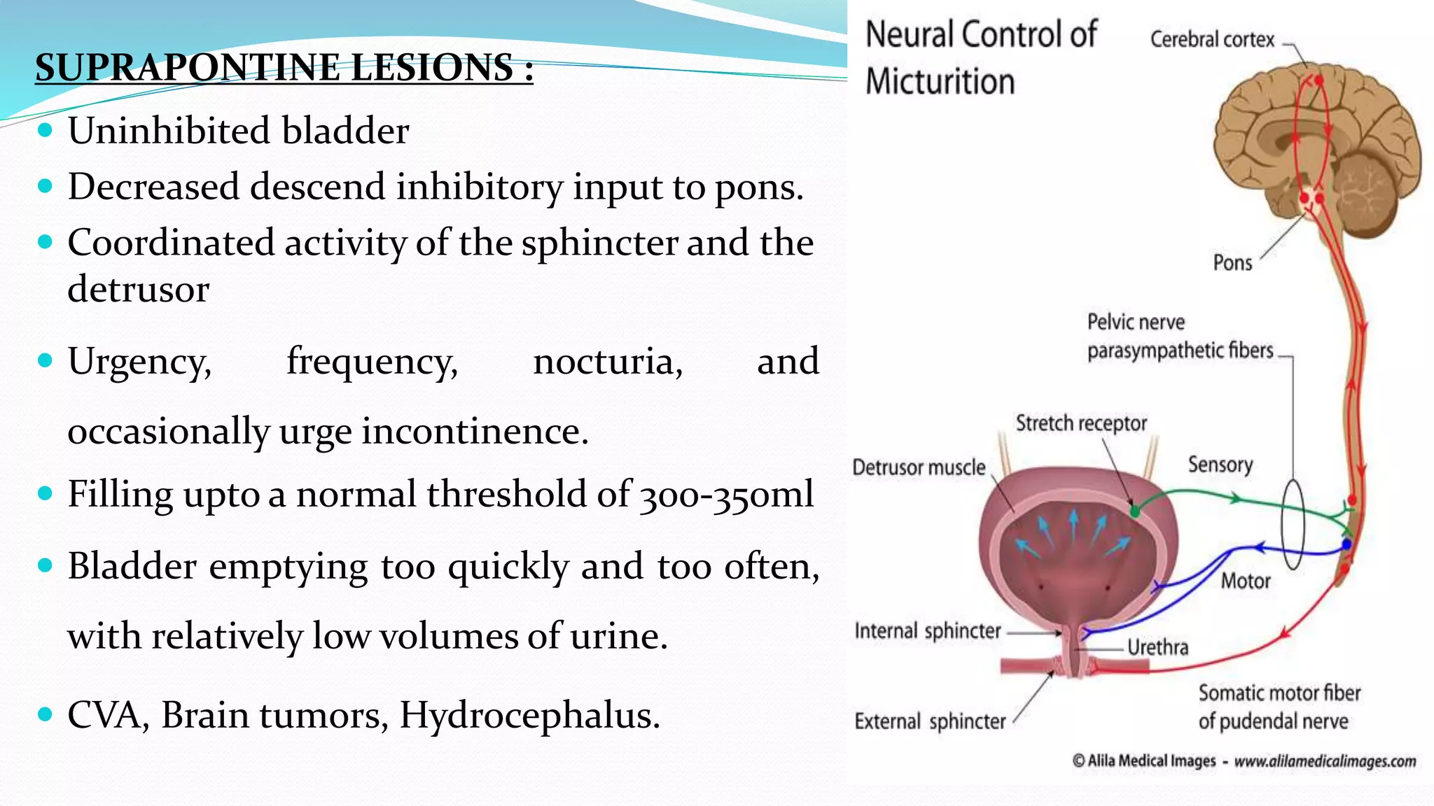 Urinary bladder dysfunction in neurosuregry | PPTX | Brain and Nervous ...