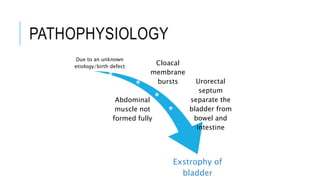 Urinary Bladder Exstrophy.pptx