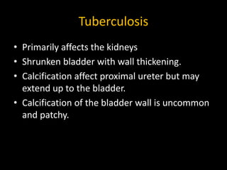 Urinary bladder pathologies | PPTX