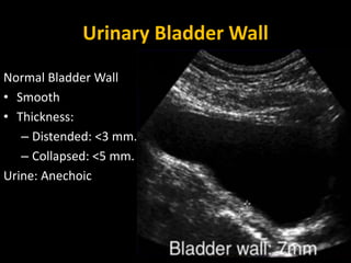Urinary bladder pathologies | PPTX