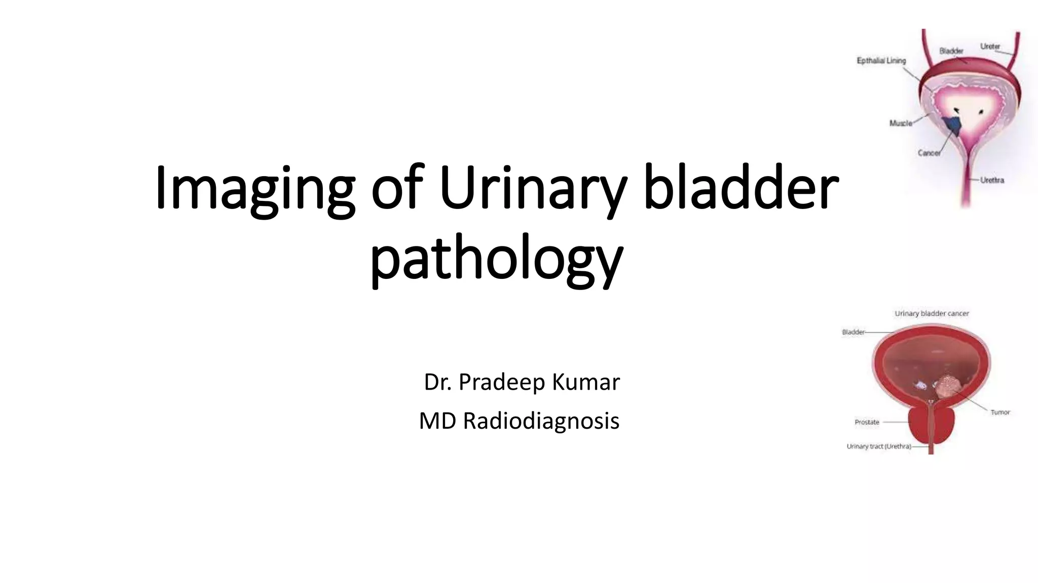 Urinary bladder pathology radiology | PPTX
