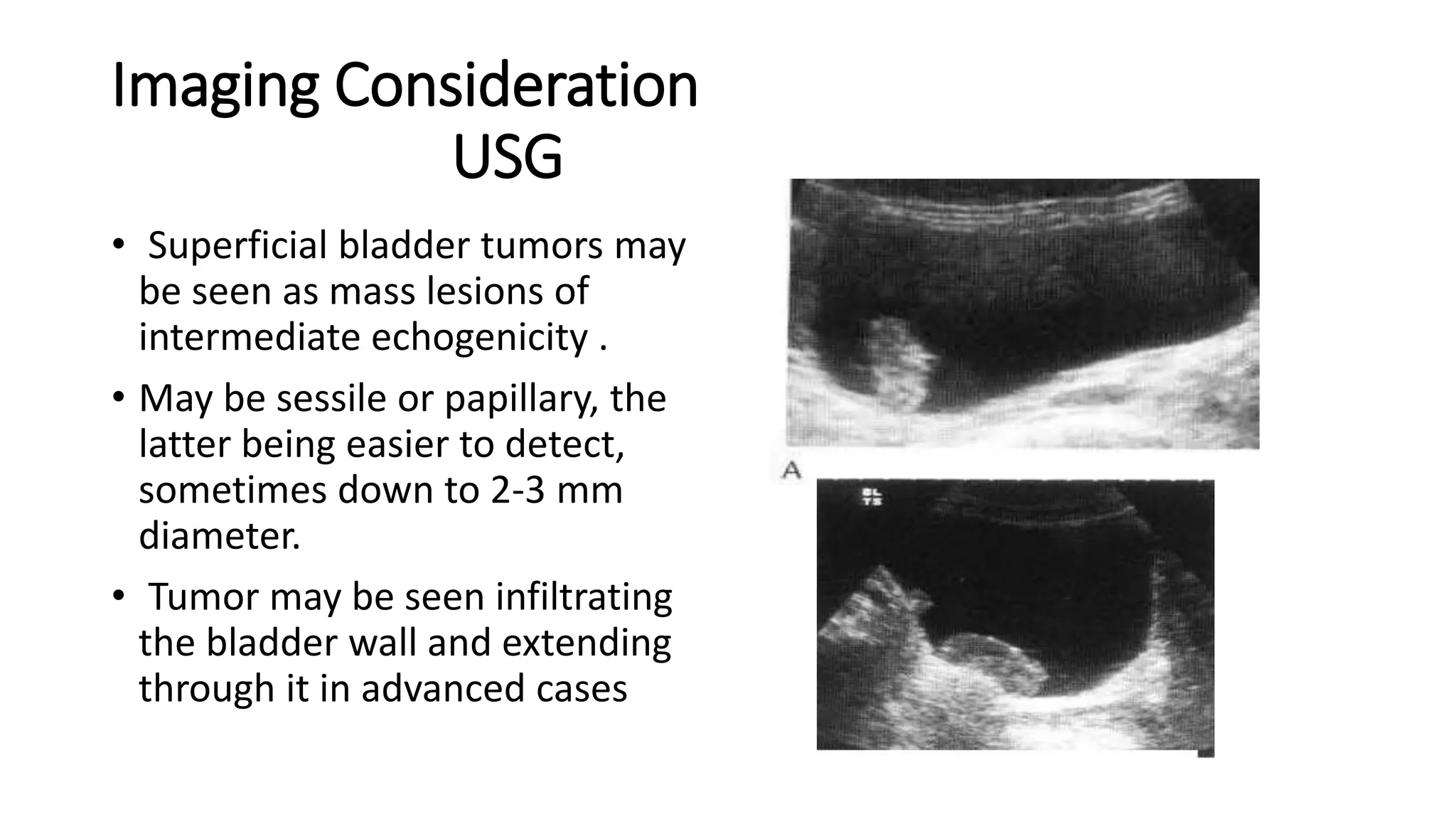 Urinary bladder pathology radiology | PPTX