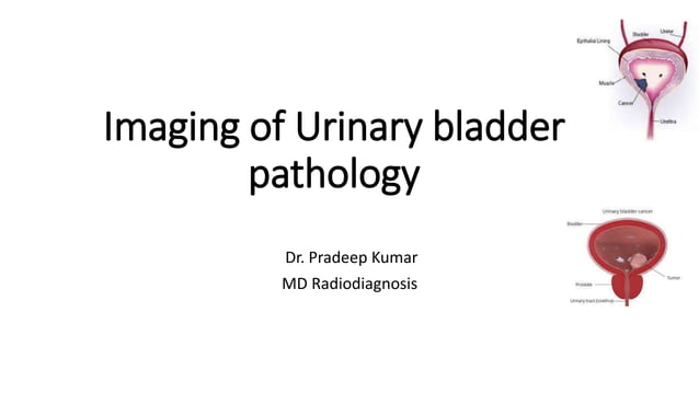 Urinary bladder pathology radiology | PPTX