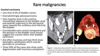 Urinary bladder pathology radiology | PPTX