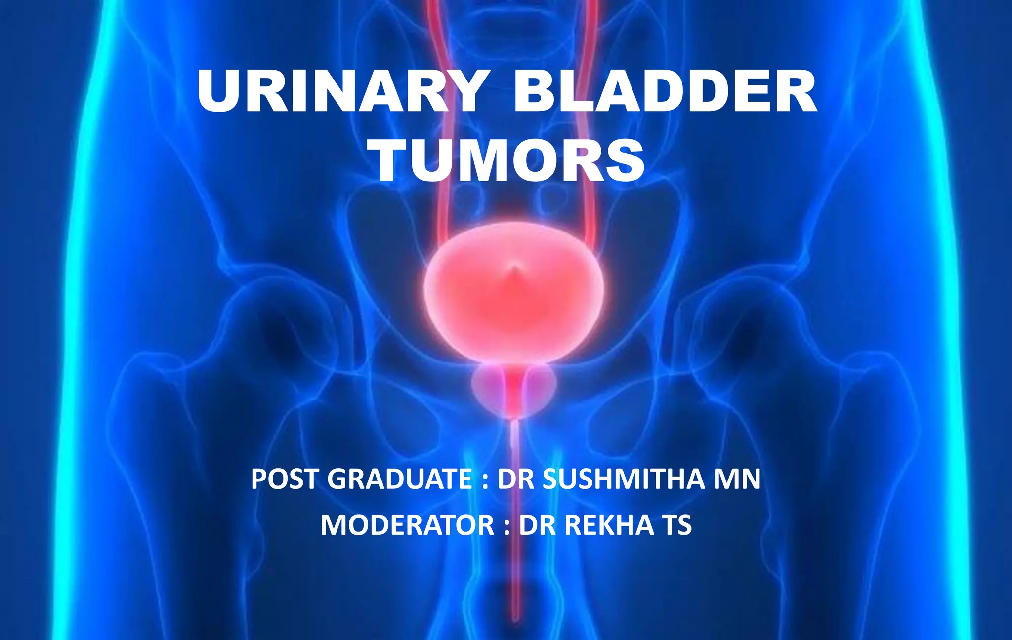 URINARY BLADDER TUMORS.pdf