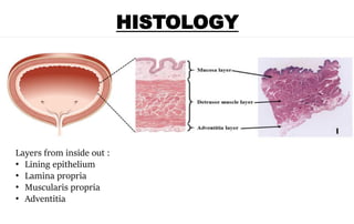 URINARY BLADDER TUMORS.pdf