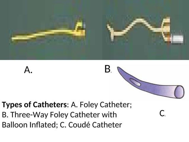 URINARY_CATHETERAZATION Medical and surgicalppt | PPT