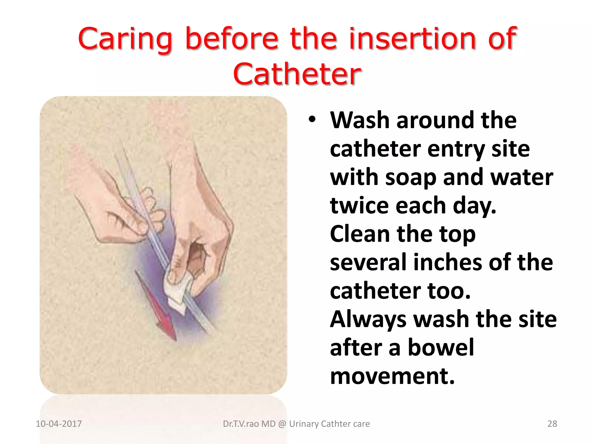 Urinary Catheter Care Principles of Care and Asepsis | PPTX