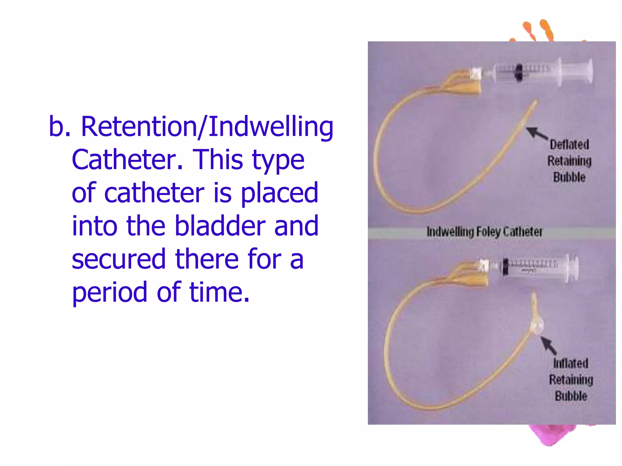 Urinary Catheterization | PPTX