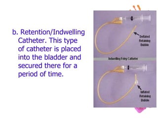 Catheters 101: The Basics Of Urinary Catheter Types, 57% OFF