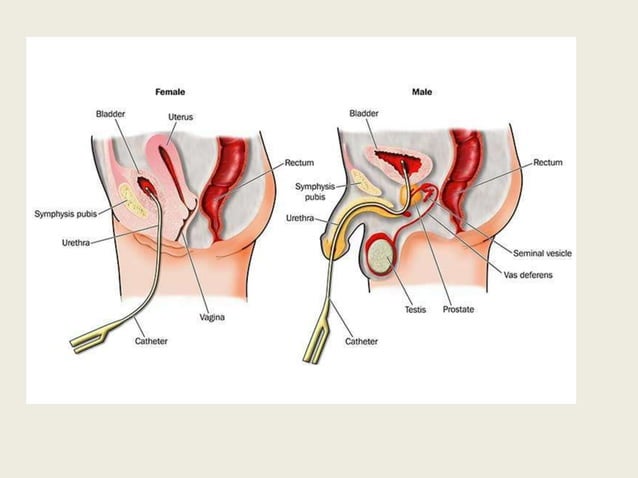 Urinary System Catheterization Procedure Pptx