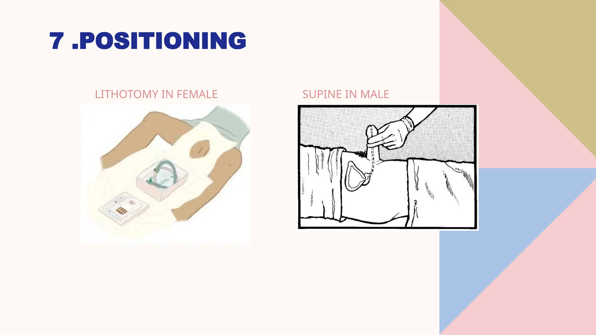 URINARY CATHETERIZATION. Urinary catheterization is a routine but ...