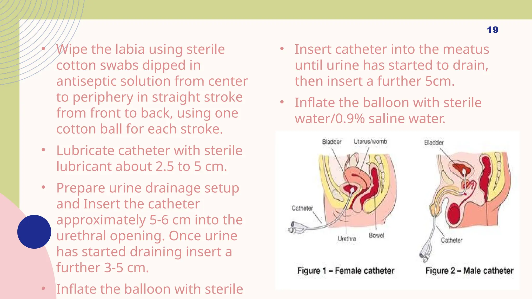 URINARY CATHETERIZATION. Urinary catheterization is a routine but ...