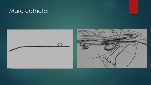 Urinary catheterization in male and female.pptx