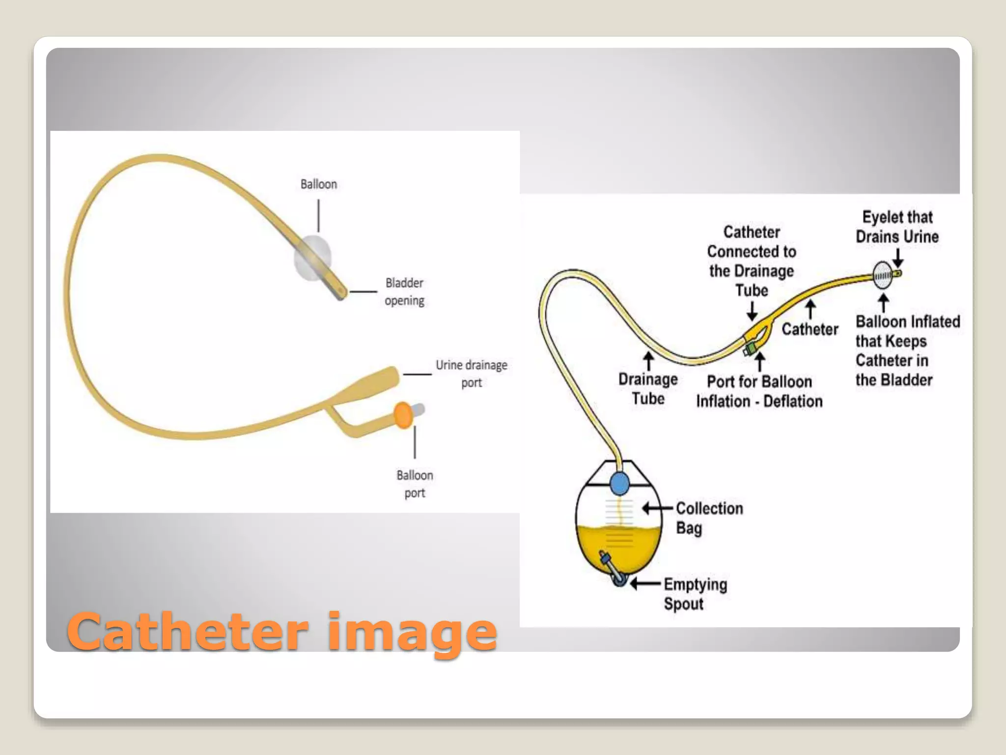 Urinary Catheterization Nursing Procedure & Management ppt.pptx