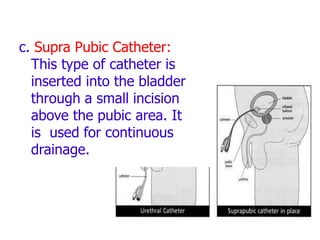 Urinary catteterization | PPTX