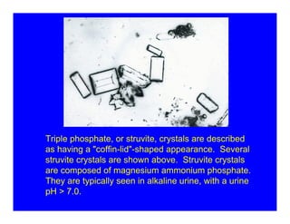 Urinary crystals | PDF