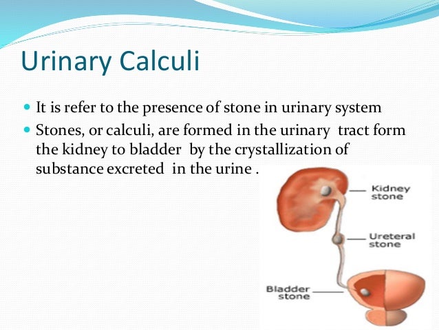 Urinary calculi by waheed