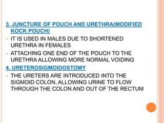 Urinary diversions | PPTX