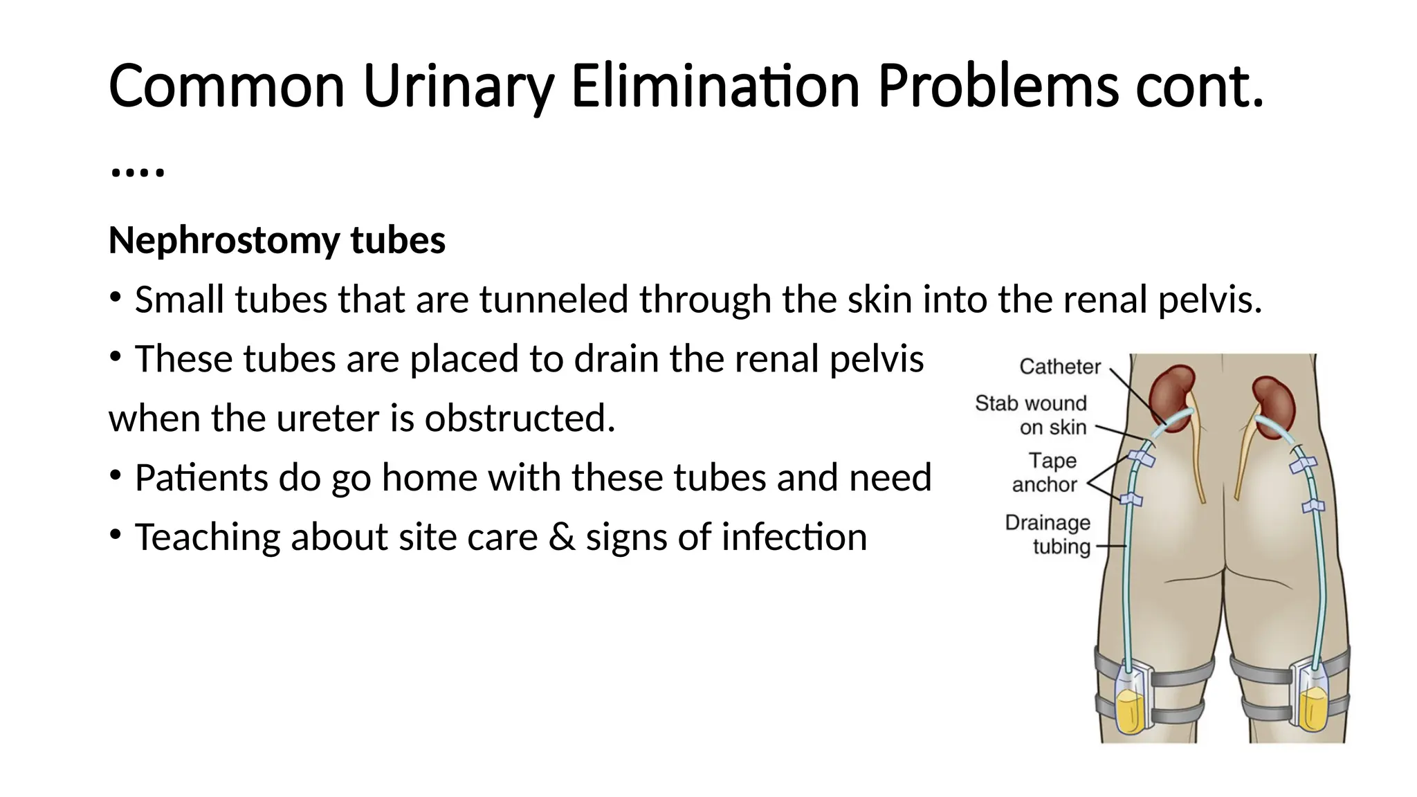 Urinary elimination and altered patterns | PPTX