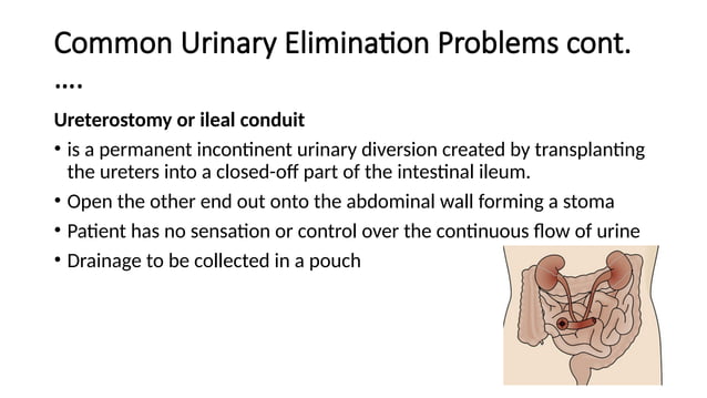 Urinary elimination and altered patterns | PPT