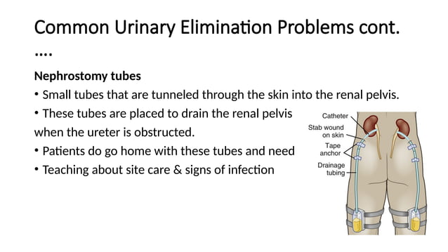 Urinary elimination and altered patterns | PPT