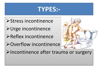 ppt on Urinary incontinence | PPTX
